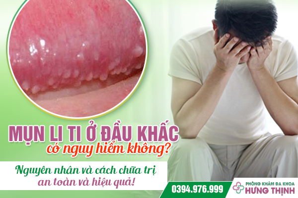 Mụn li ti ở đầu khấc có nguy hiểm không? Nguyên nhân và cách chữa trị an toàn và hiệu quả!